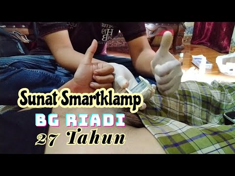 sunat perbaikan, bang riadi 27 tahun, metode smartklamp / ruangsunat ...