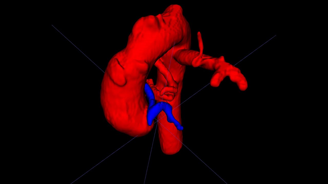 DU CPC Université de Paris Francesca Raimondi Indications IRM scanner ...
