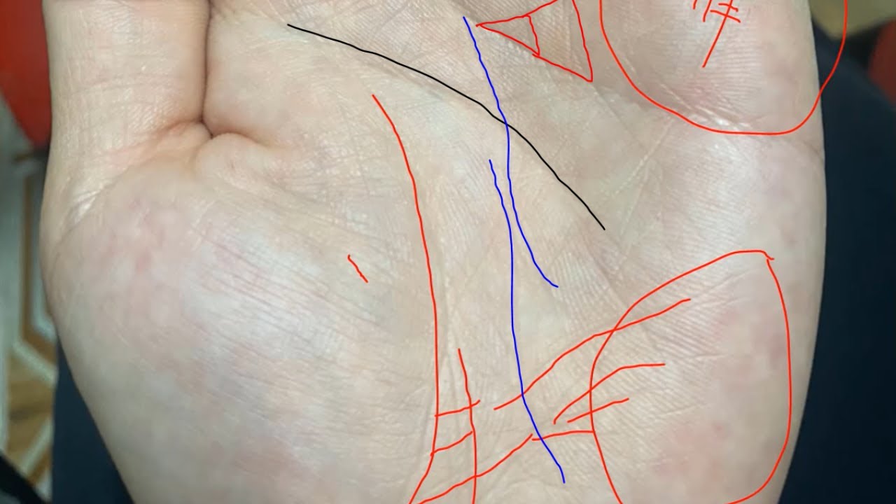 Bankruptcy Palm Signs – How to Identify and Avoid Them Quickly - YouTube