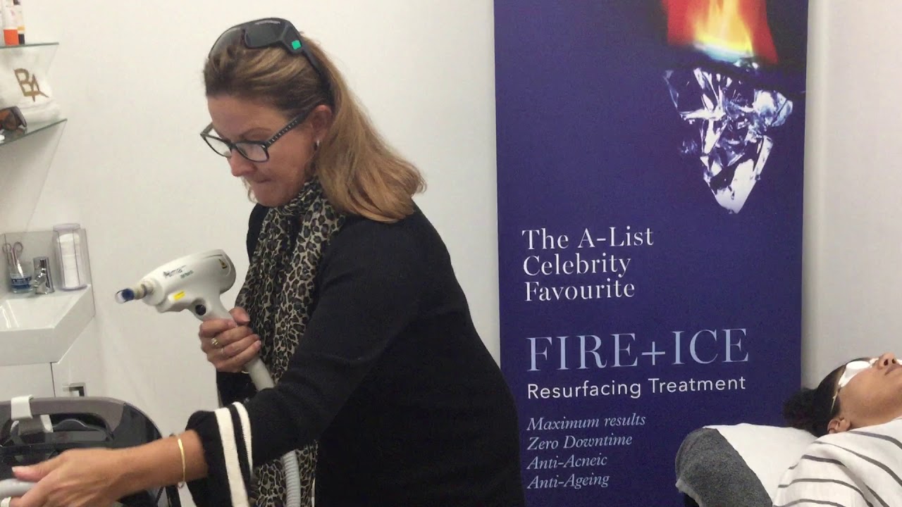 Clearlift Pixel Treatment - YouTube