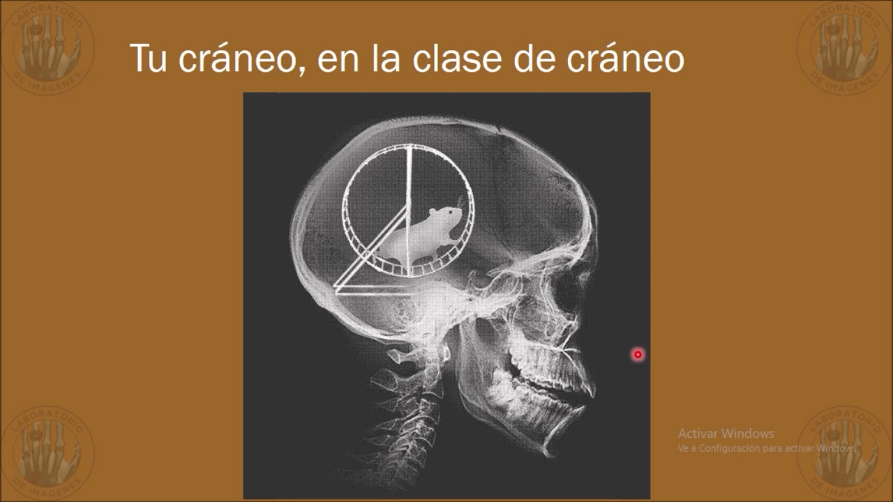 Anatomia Imagenologica del Craneo (RX, Tomografia) - YouTube