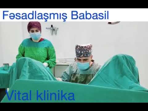 VİTAL KLİNİKA Fəsədlaşmış Babasil əməliyyatı.
