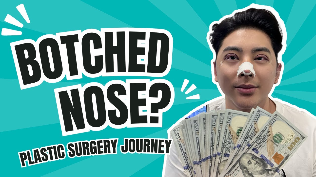 BOTCHED NOSE? | Plastic Surgery Journey - YouTube