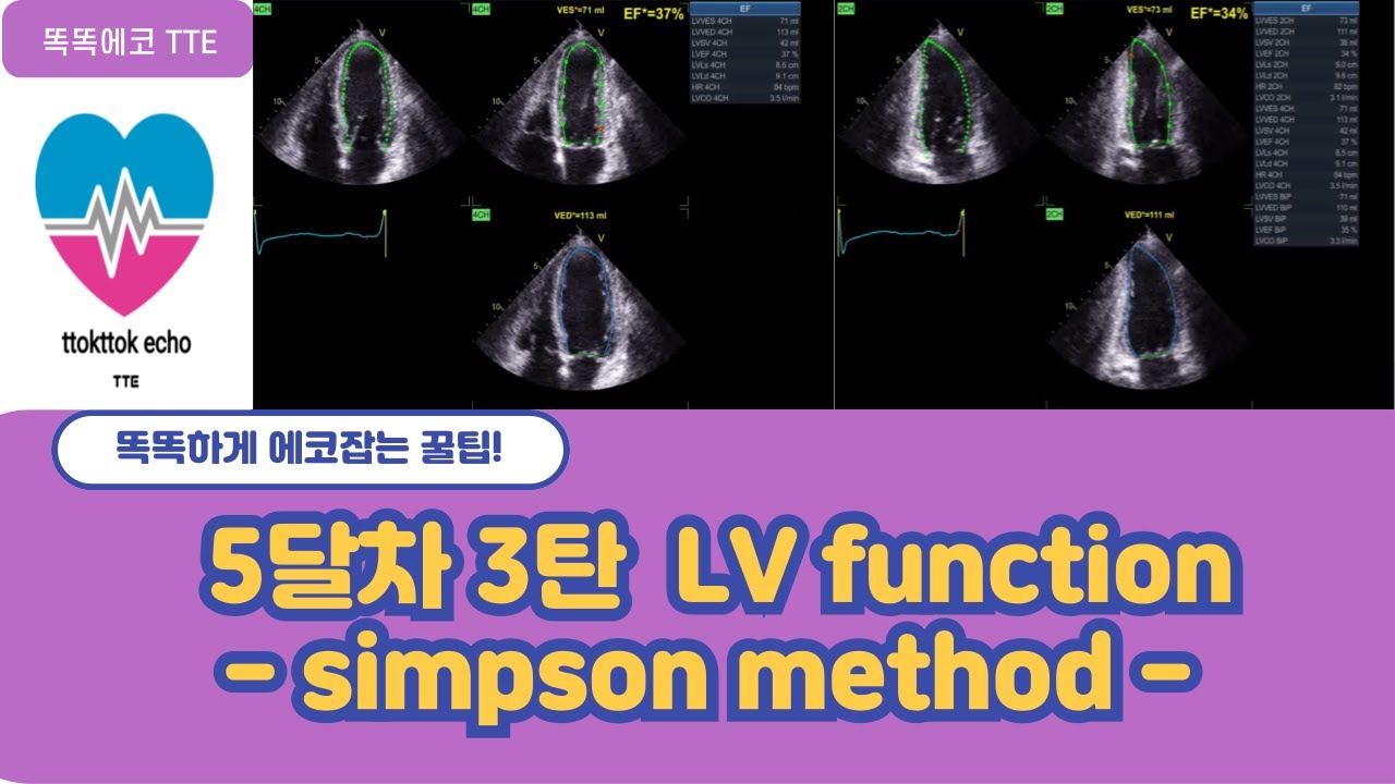 Biplane simpson method #echocardiography #심장초음파 #heart #echo view # ...