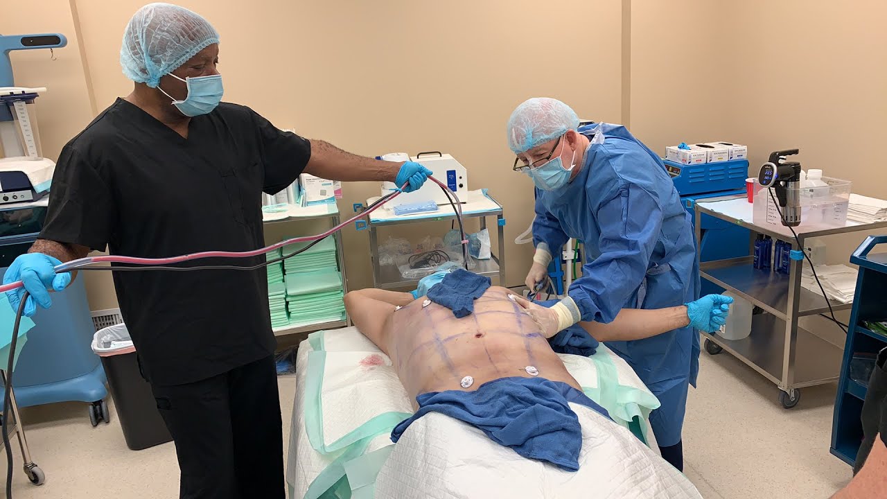 LEBO GYNO TOUCH UP - YouTube