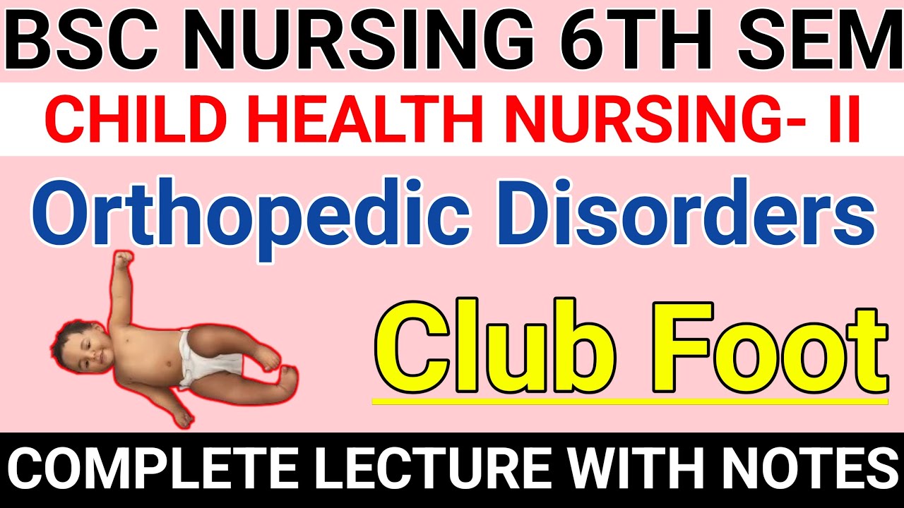 CLUB FOOT: TYPES, CAUSES, SYMPTOMS & MANAGEMENT IN SHORT NOTES| QUICK ...