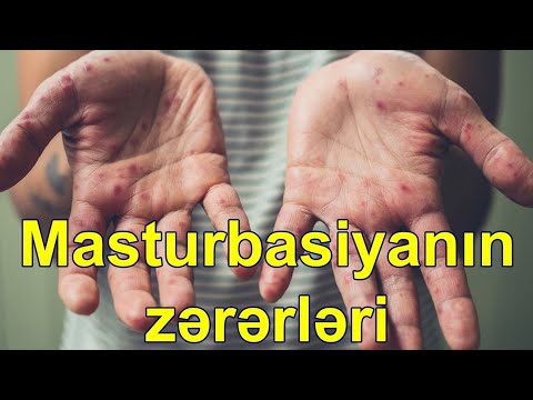 Masturbasiya kişilərdə xəstəlik yaradır? - ŞOK