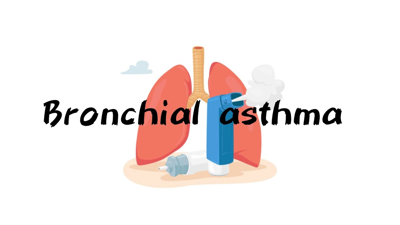 Bronchial asthma - definition , types , pathogenesis , clinical ...