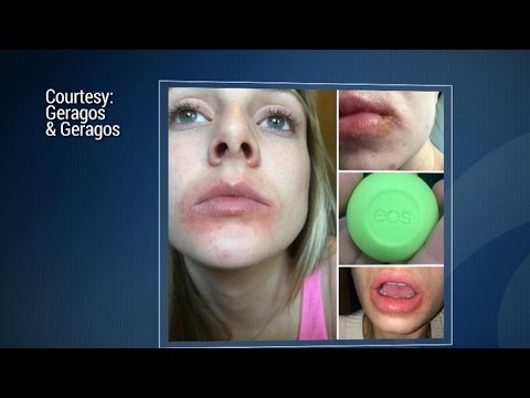 Lawsuit claims EOS lip balm is giving people rashes and blisters - YouTube