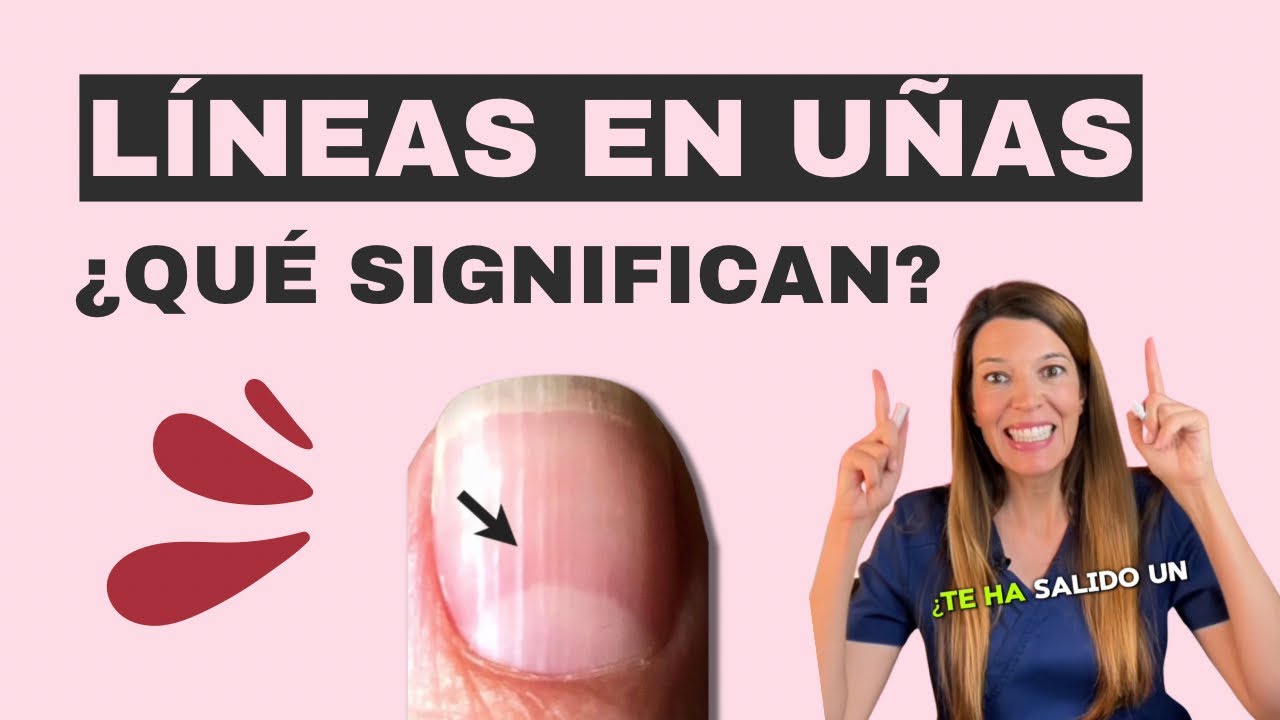 Líneas en las uñas: Dermatóloga lo explica. - YouTube
