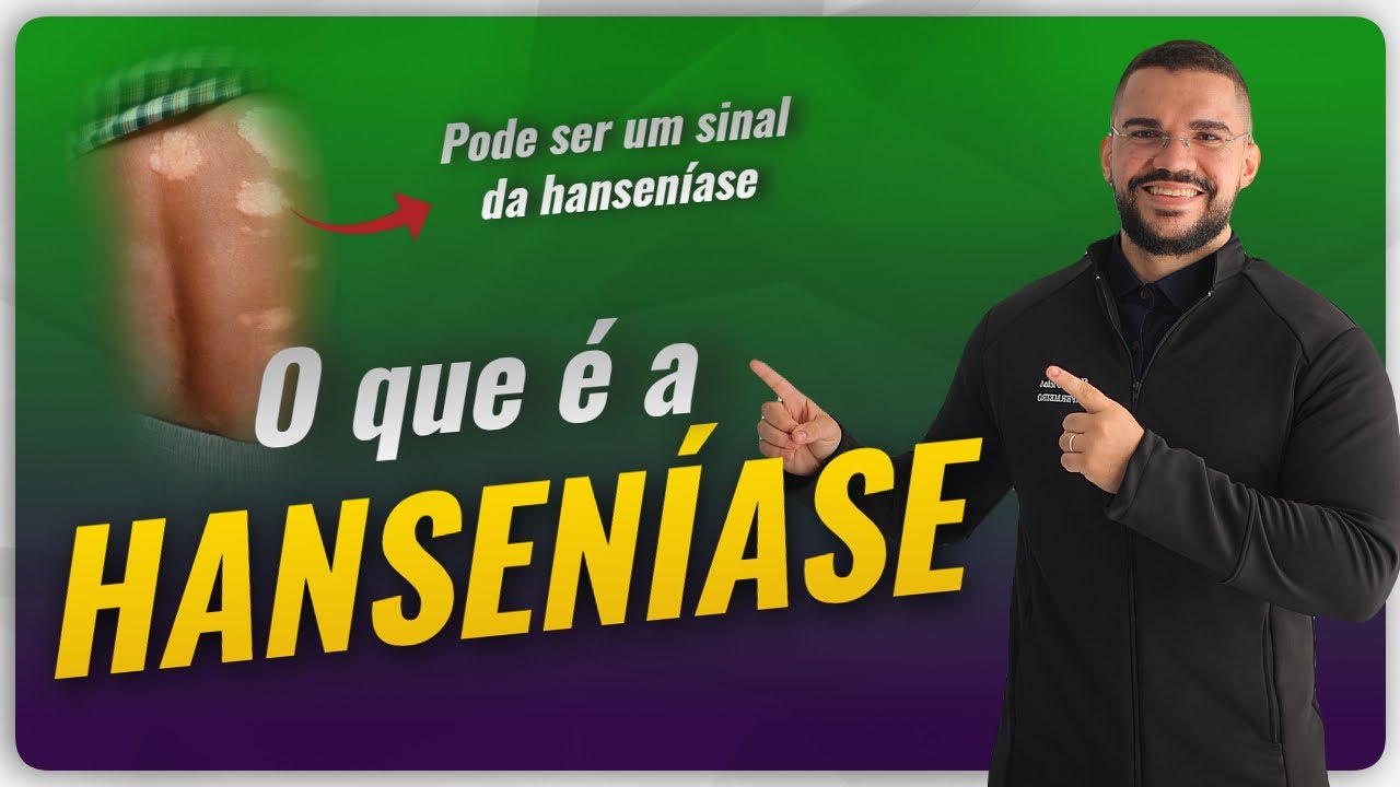 O QUE É A HANSENIASE TUDO SOBRE A HANSENIASE - YouTube