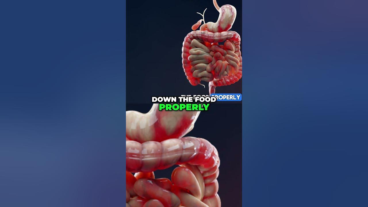 Why Post-Meal Naps Can Harm Your Health - YouTube