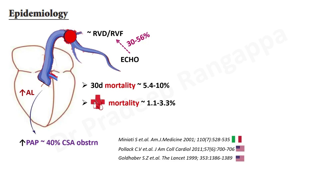 RV (Right Ventricle) in ICU ~ Overlooked - YouTube