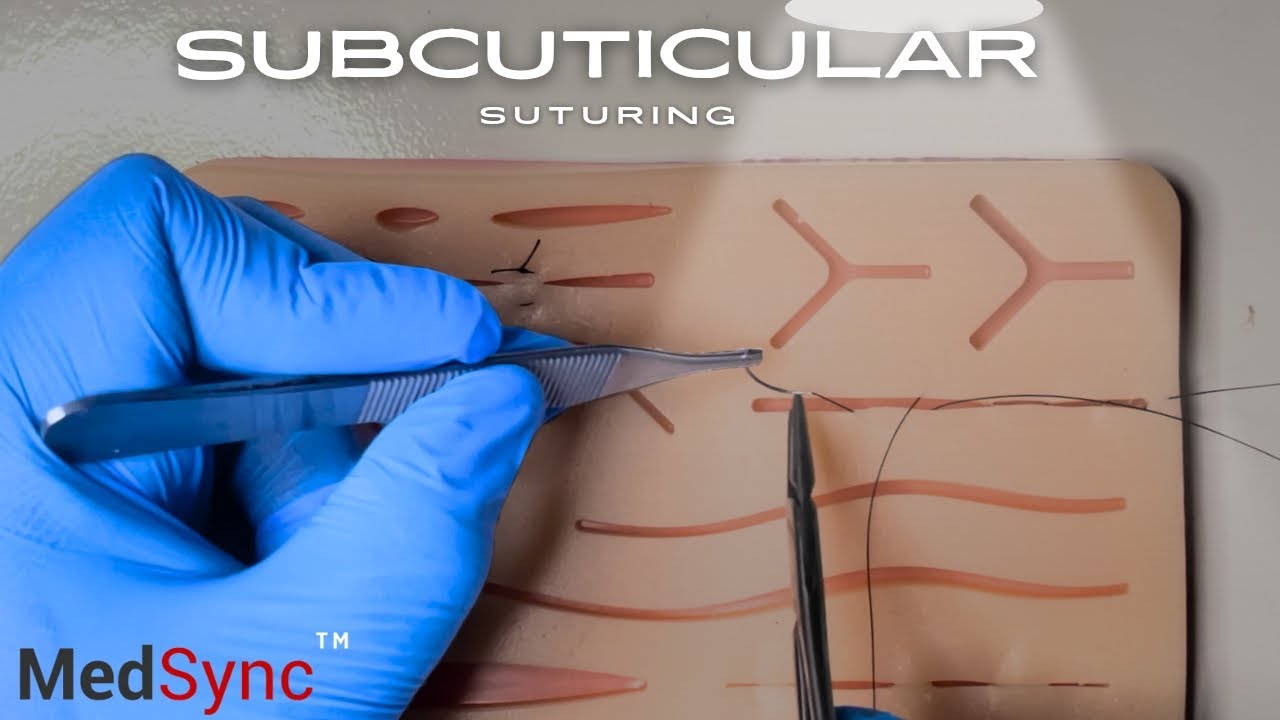 Subcuticular Sutures: The intradermal Stitch Patients Love - This Is ...