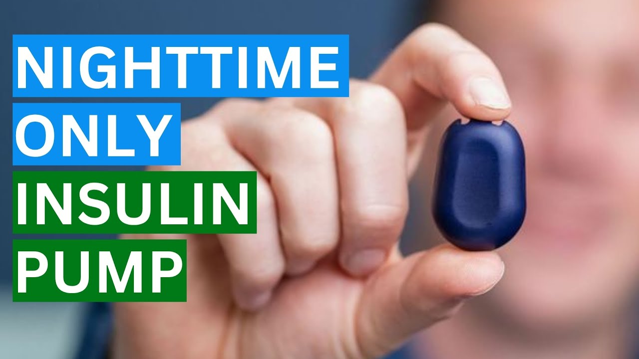 The First Nighttime-Only Insulin Pump (Luna Diabetes) - YouTube