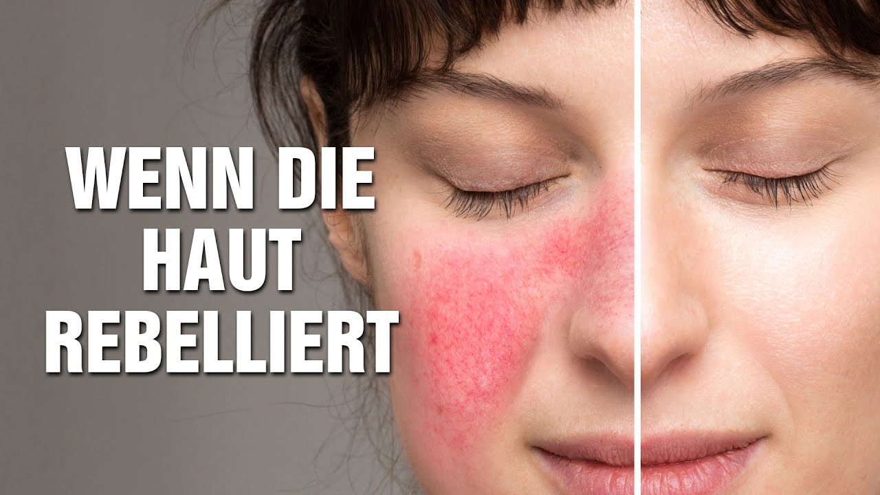 Was tun, wenn die Haut rebelliert? - Ganzheitliche Heilung der Haut am ...