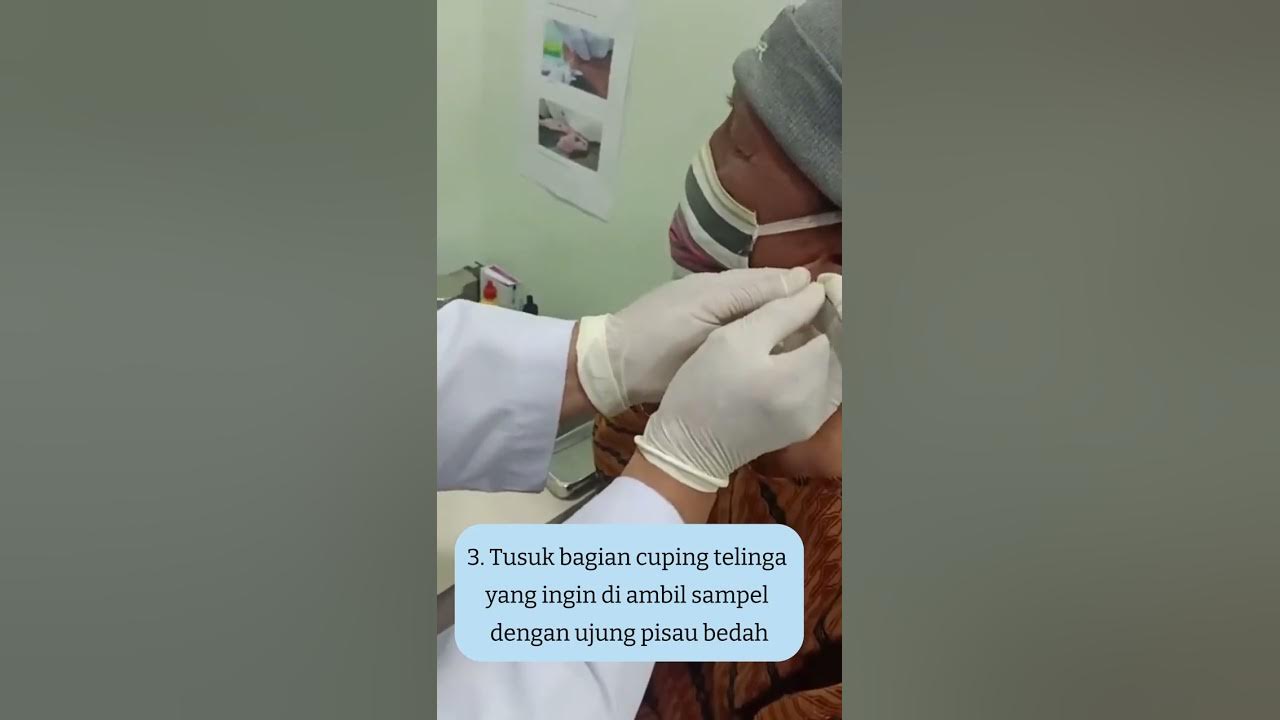 TUGAS BAKTERIOLOGI 2 TEORI (CARA PENGAMBILAN SAMPEL LEPRA DENGAN CUPING TELINGA) - YouTube