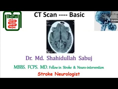 CT Scan Head - Basic | Prof. Dr. Md. Shahidullah Sabuj - YouTube
