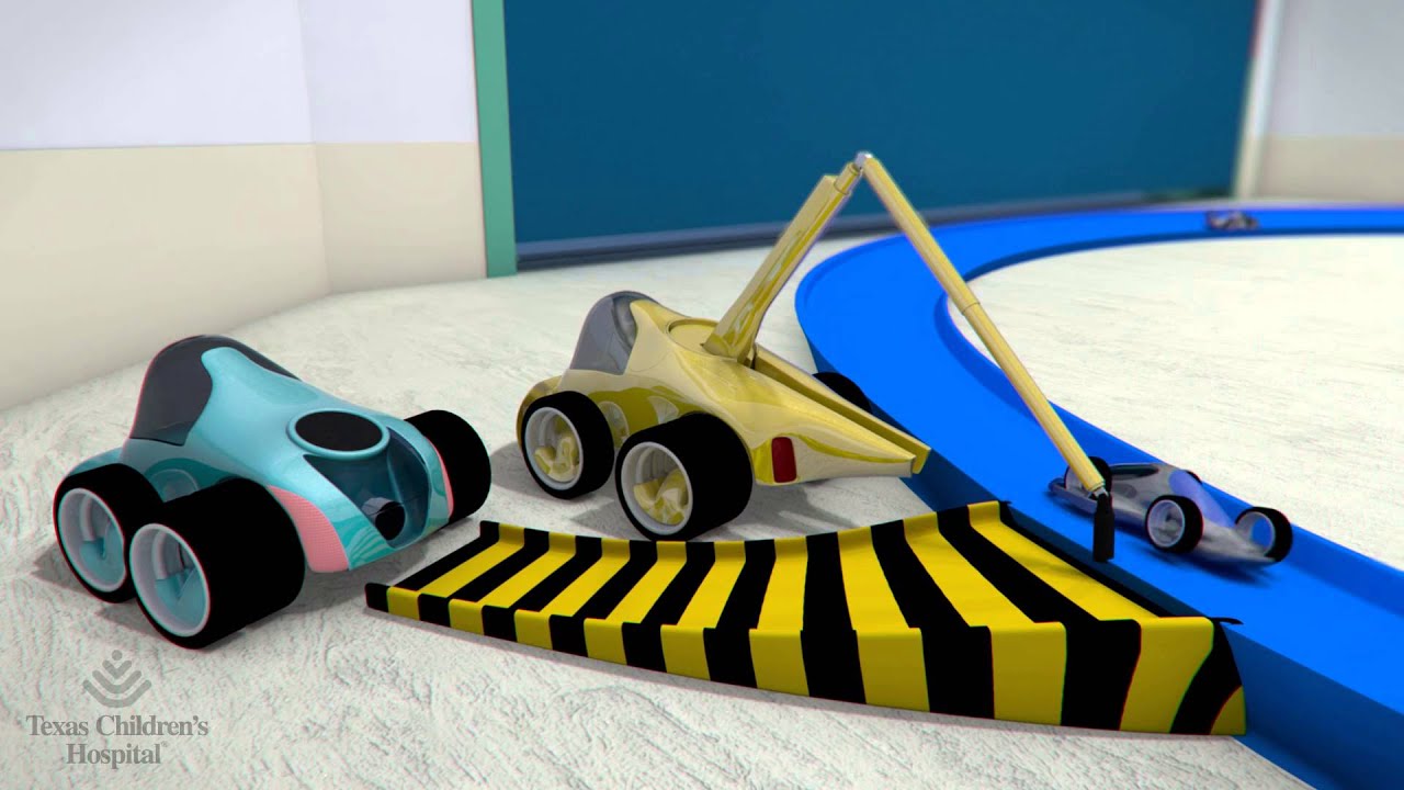 Atrial Septal Defect/Umbrella Closure: Texas Children's Heart Center ...