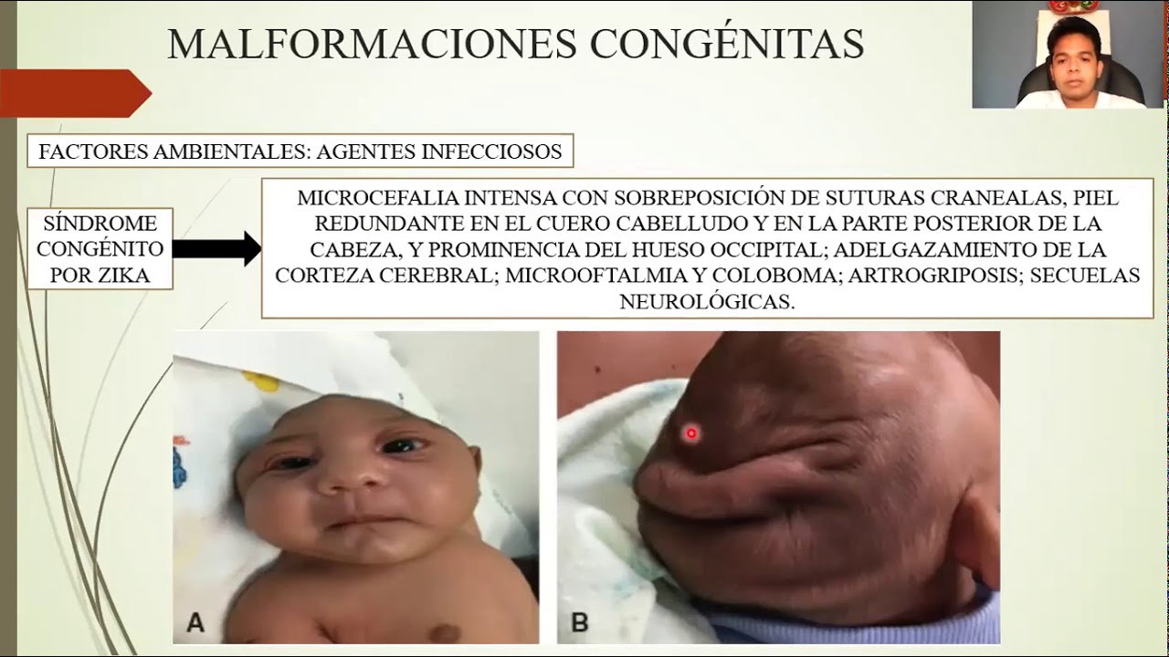 EMBRIOLOGÍA: DEFECTOS CONGÉNITOS Y DIAGNÓSTICO PRENATAL - YouTube