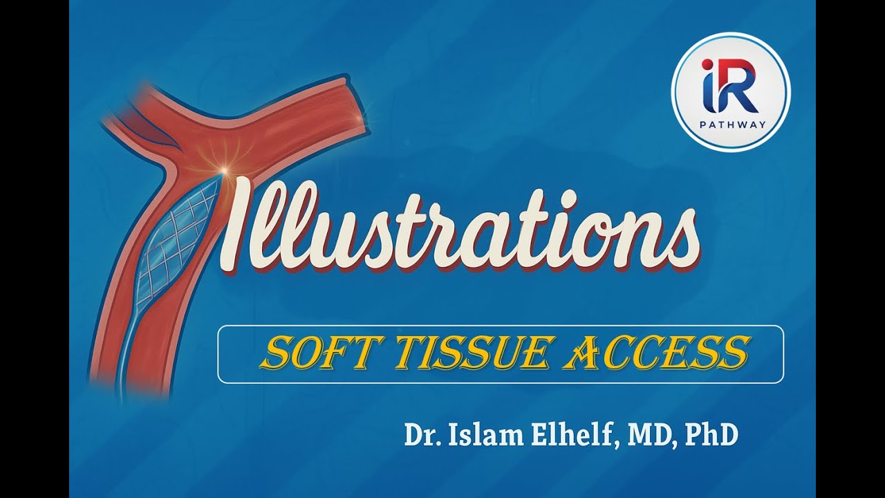Soft Tissue Access - Animation - YouTube