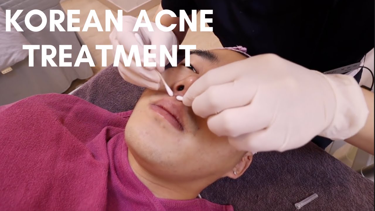 Acne Fighting Chemical Peel | Seoul Guide Medical - YouTube