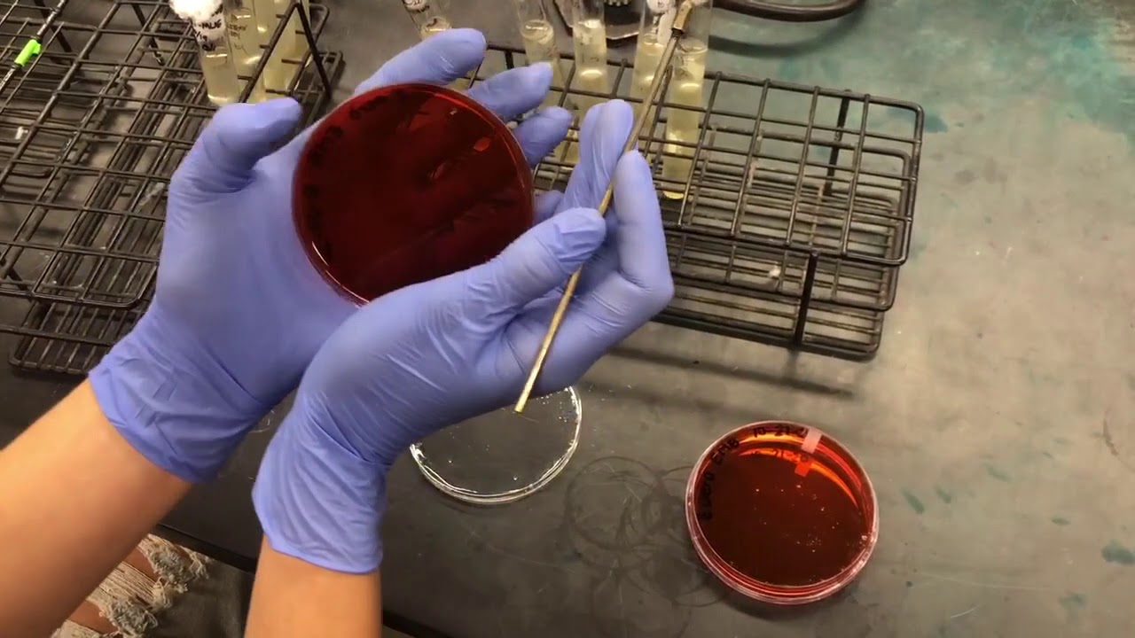 Exercise 21A: Most probable Number (MPN) method for coliform analysis ...