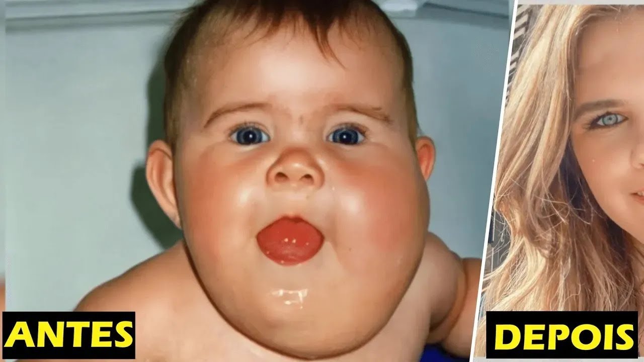 Bebê é abandonada por ser "FEIA DEMAIS” é adotada e sua aparência é ...