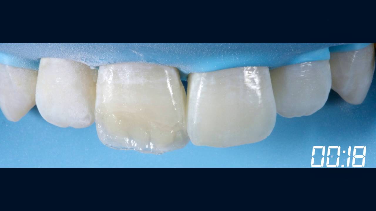 The Emergency Class IV - YouTube