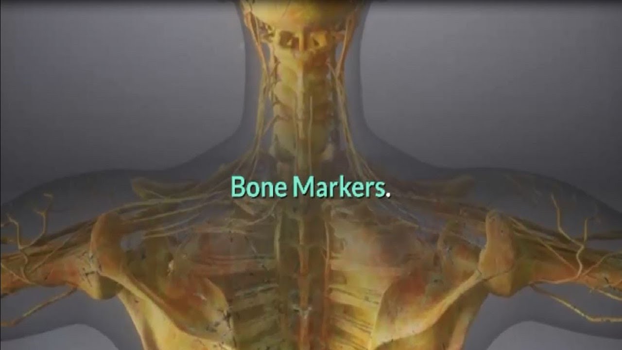 Bone Markers !!! - YouTube
