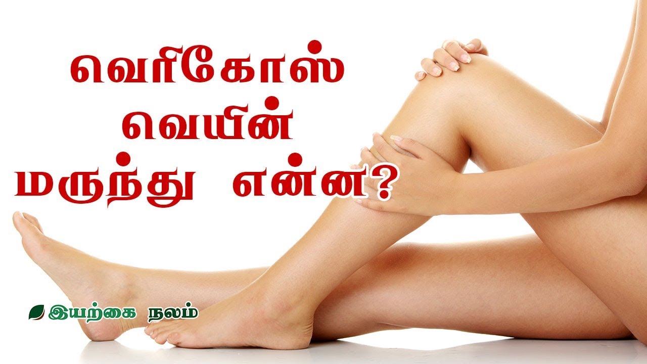 Varicose Vein In Tamil Language varicose-vein-in-tamil-language