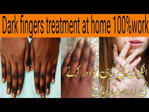 Lighten Dark Finger&Knuckle Home remedy/Do this 7 Days your Fingers ...