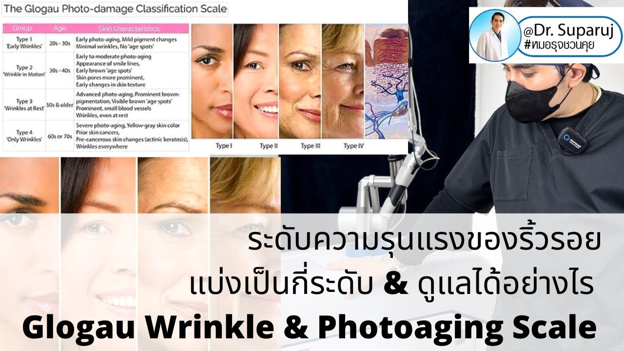 ระดับความรุนแรงของริ้วรอย แบ่งเป็นกี่ระดับ & ดูแลได้อย่างไร Glogau ...