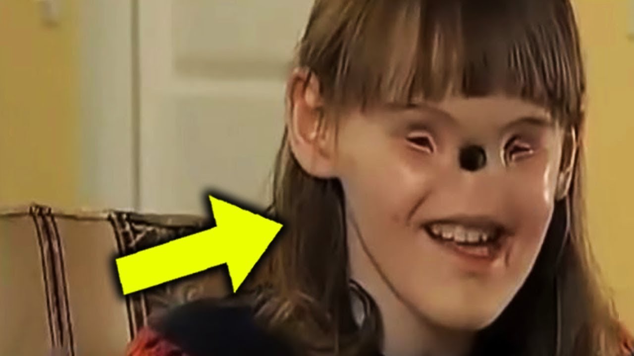this girl was born without nose and eyes – but no one could expeted ...