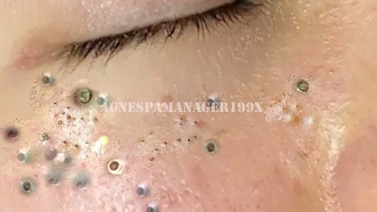 𝐏𝐫𝐨𝐟𝐞𝐬𝐬𝐢𝐨𝐧𝐚𝐥 𝐑𝐨𝐲𝐚𝐥 𝐅𝐚𝐜𝐢𝐚𝐥 𝐂𝐚𝐫𝐞 𝐰𝐢𝐭𝐡 𝐓𝐇 | 𝟒𝟕𝟖𝟔 - YouTube
