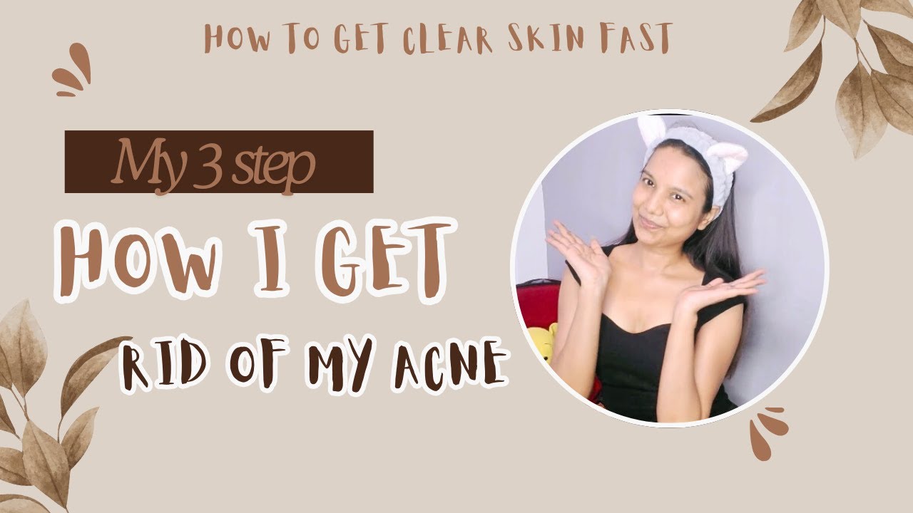 HOW TO CLEAR ACNE AND PIMPLES | 3 STEPS | SKINCARE FACTS & TIPS FOR ...
