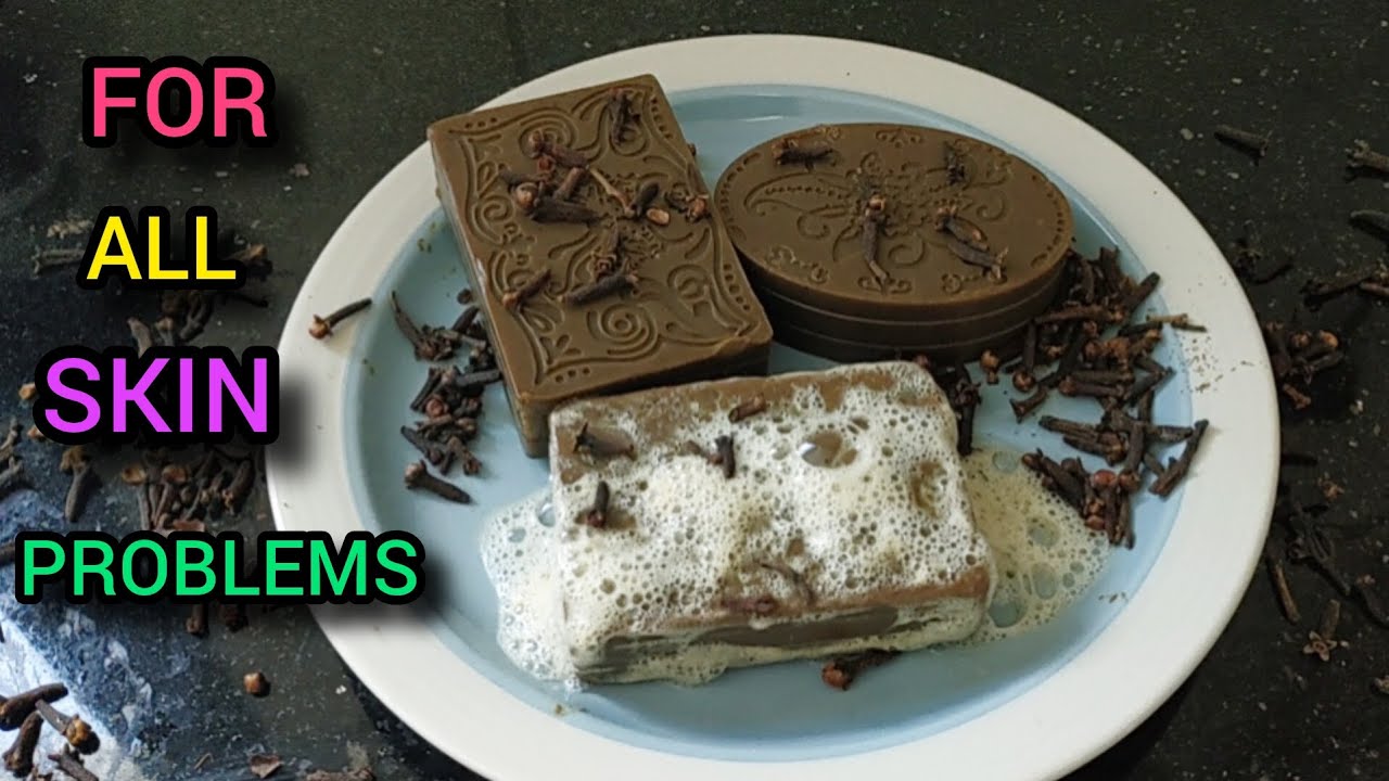 Home made cloves soap to treat acne, dark spots, pimples, itchy and ...
