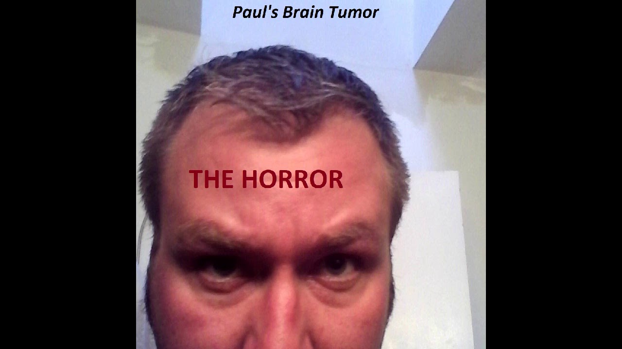 The Horror - Paul's Brain Tumor - YouTube