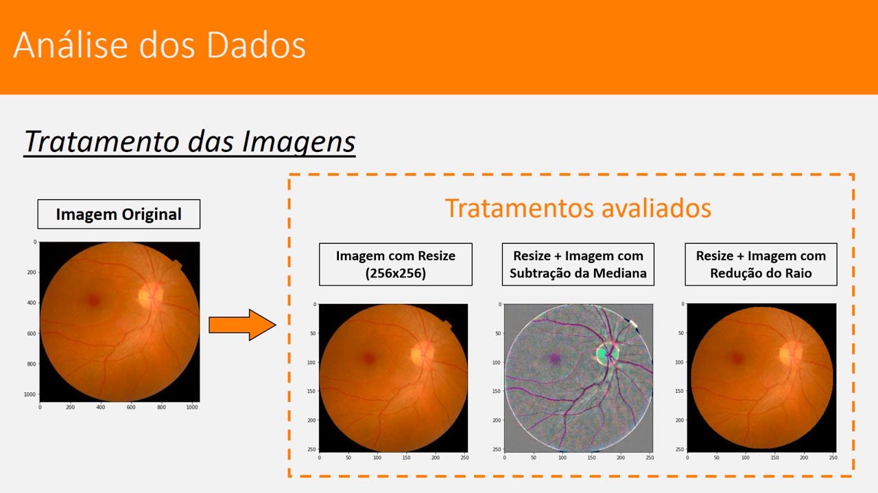 Blindness Detection - Work4Data - YouTube