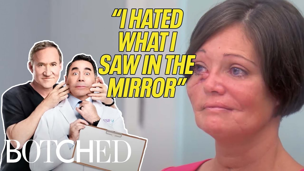 5 EMOTIONAL Patient Stories on "Botched" (BEFORE & AFTERS) | Botched ...