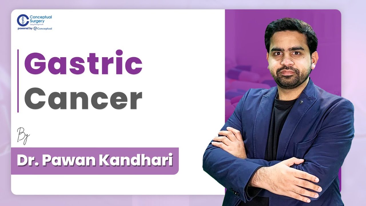 Clinical Insights into Gastric Cancer: A Case-Based Approach | Dr ...