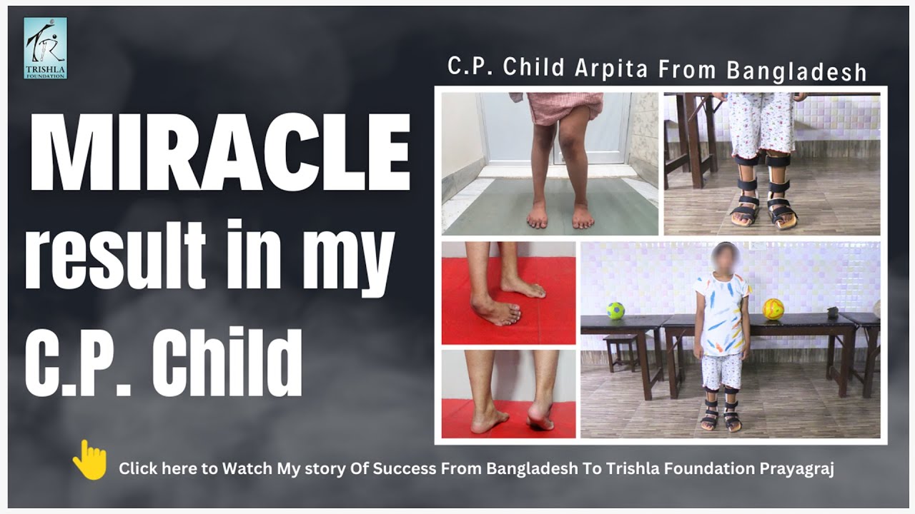 Dystonic Cerebral Palsy Treatment with toe walking Physiotherapy | Trishla Foundation - YouTube