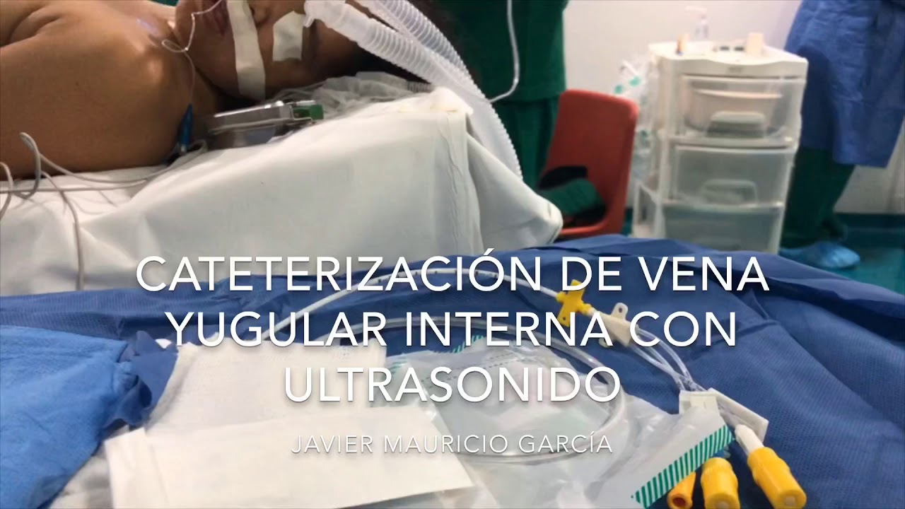 Catéter yugular interno guiado por ultrasonido - YouTube