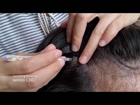 Satisfying Relaxing Cabut Uban Mamer #25 - YouTube