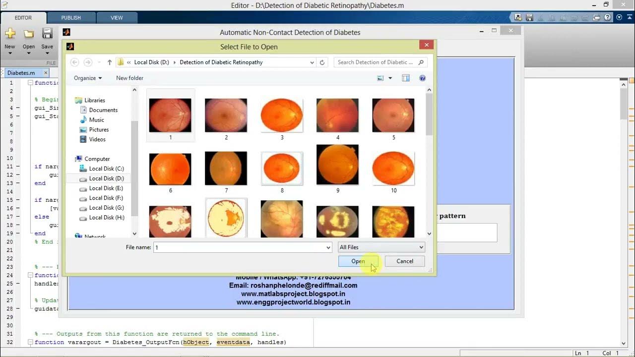 Matlab Code On Diabetic Retinopathy Classification Using Image ...
