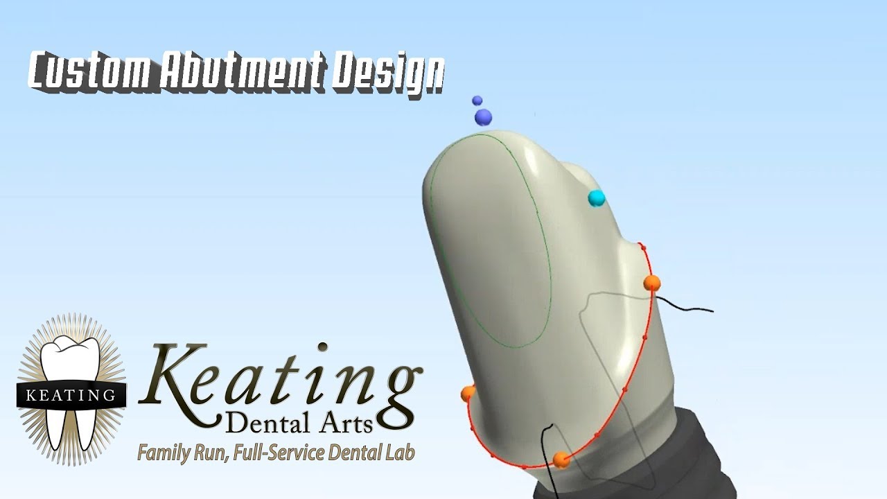 Custom Abutment Design - YouTube