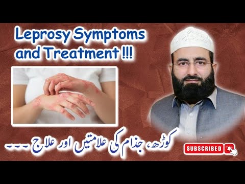 korh,jazam ki bemari ka ilaj l Leprosy Causes,symptoms and treatment/Leprosy disease in Urdu/Hindi