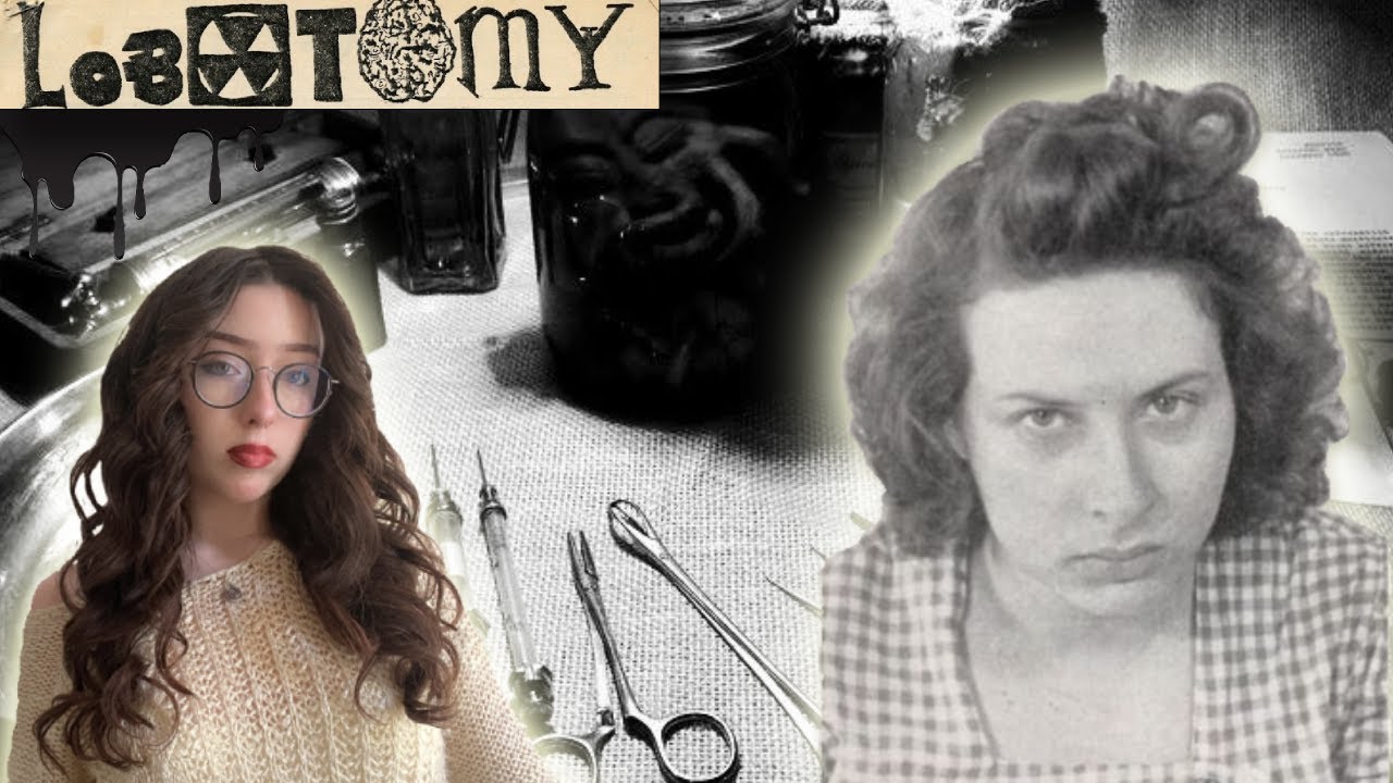 how lobotomies failed women - YouTube