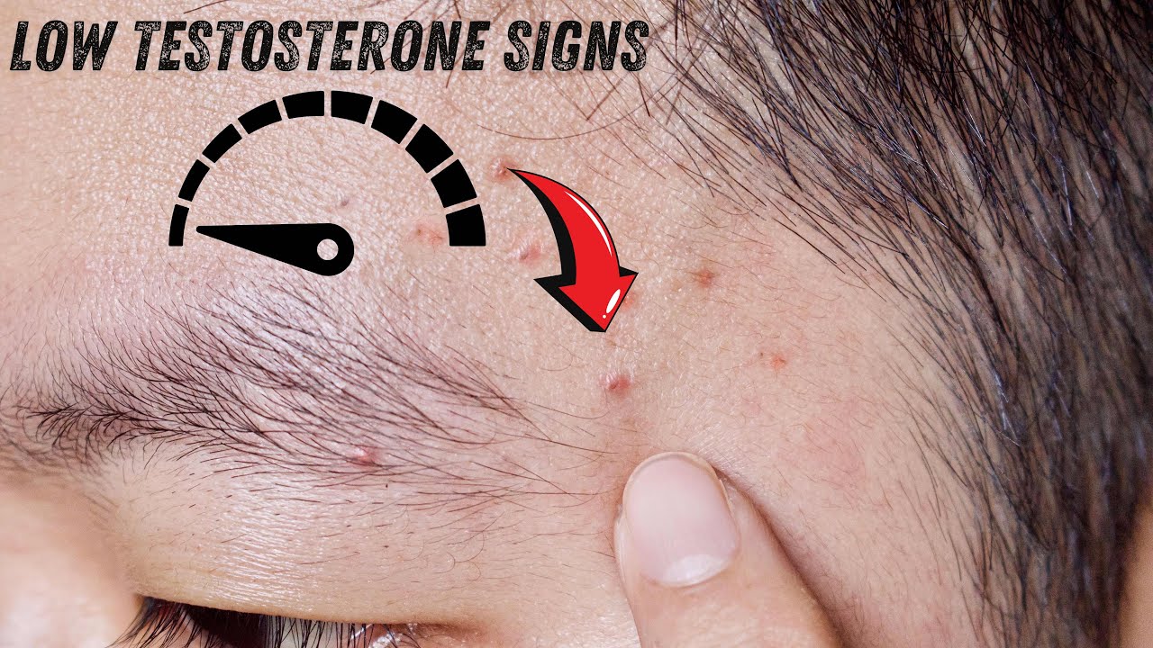 HIDDEN SIGNS OF LOW TESTOSTERONE | These Signs Shows That You Have Low ...