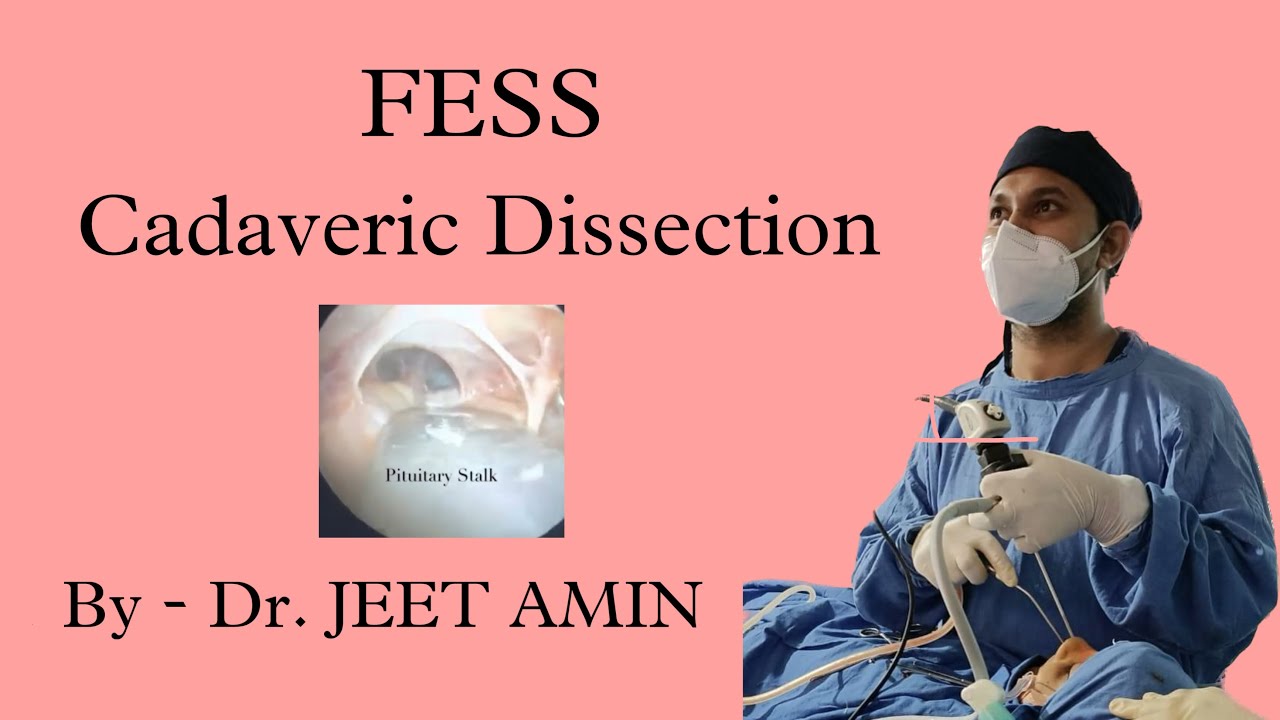 Cadaveric Dissection of Nose, Para Nasal Sinuses & Anterior Skull Base ...